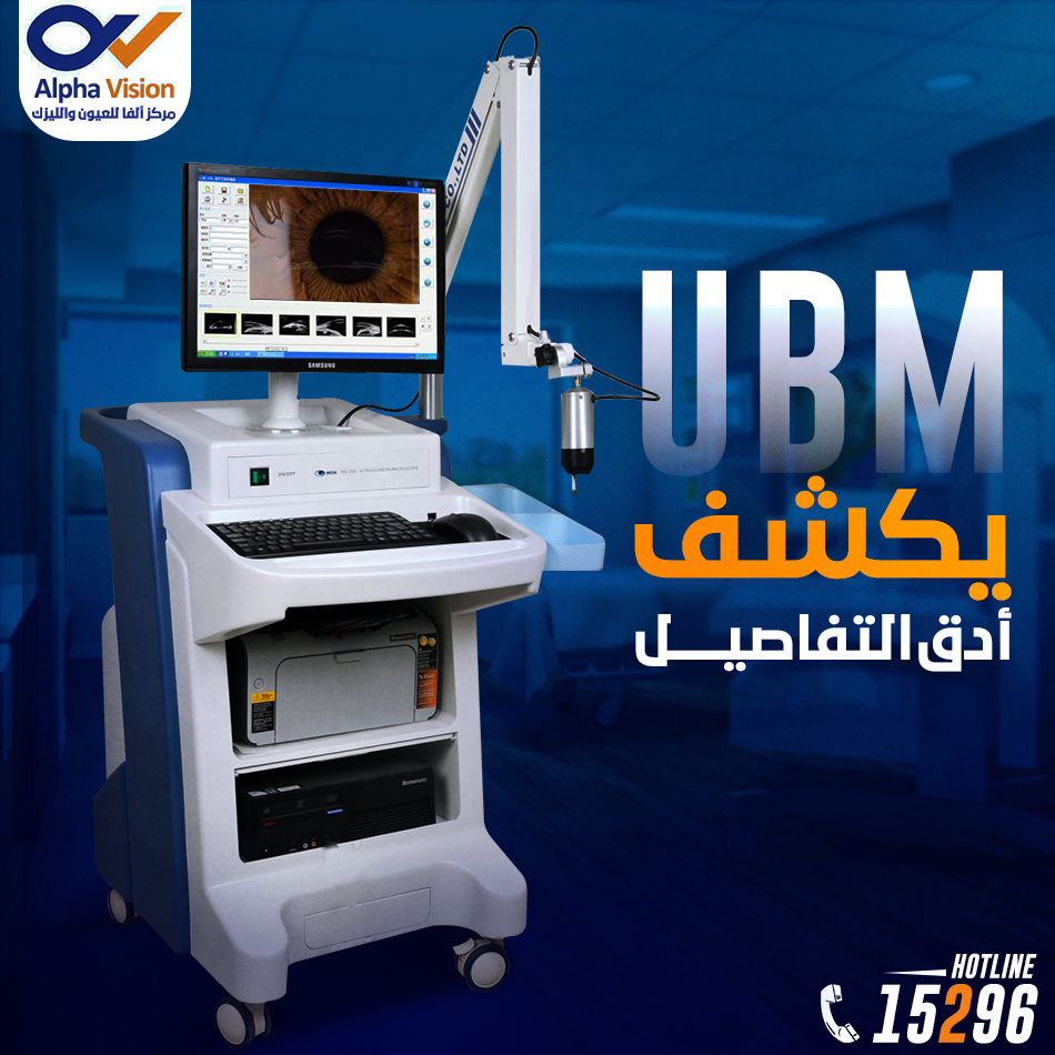 Alpha Vision - MGNSCOPE